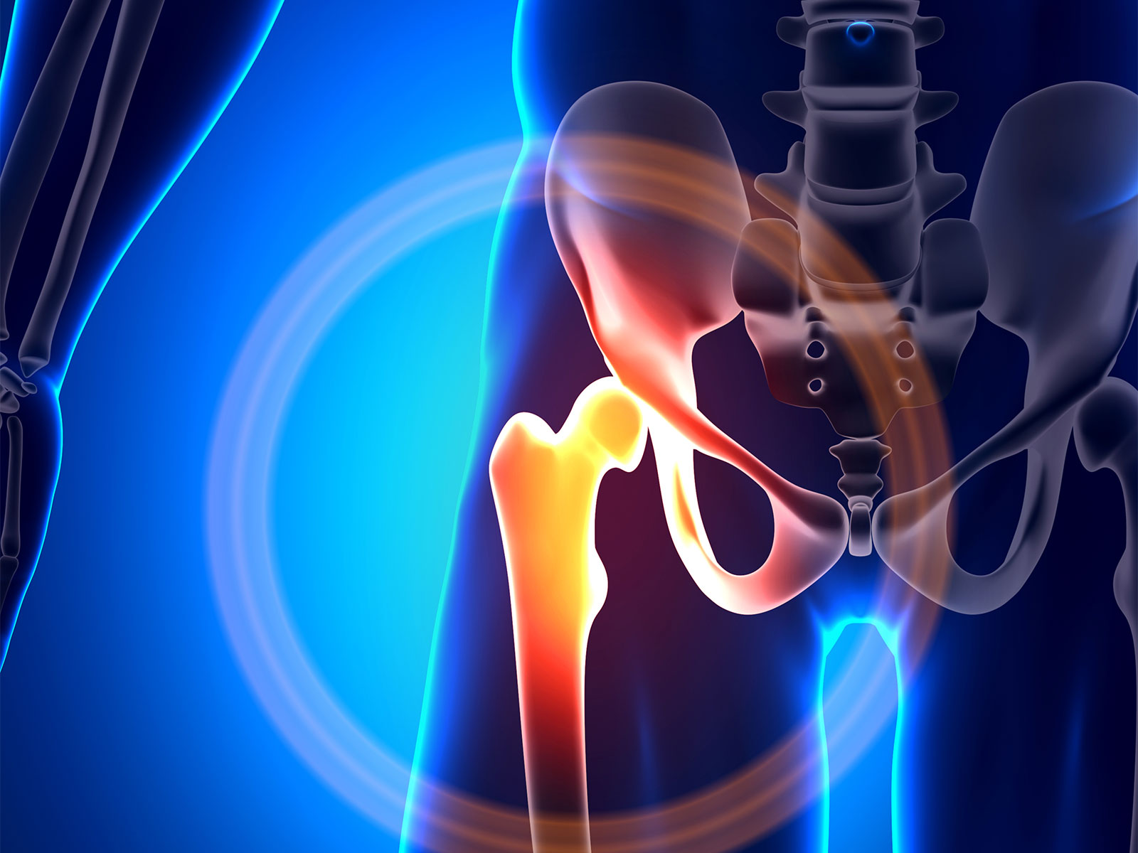 Hip Replacements for Obese Patients - Why Our Approach Is Better