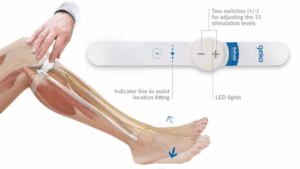 The Geko Device: Our Advanced Healing Tool for Enhanced Recovery at ...