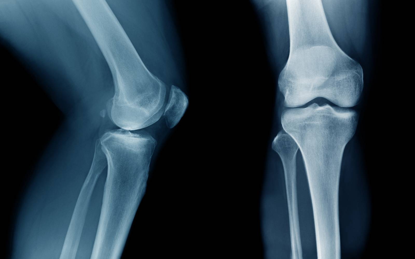 What Happens During an MRI, X-Ray or Ultrasound? Your Guide to What to ...